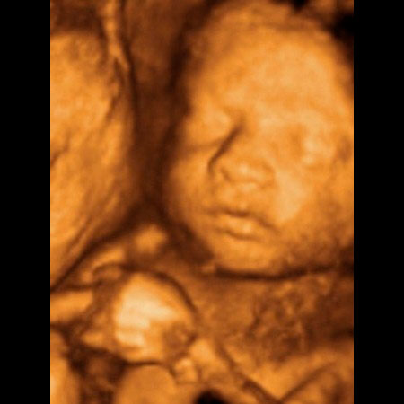 GALERÍA DE IMÁGENES | Cid Baby